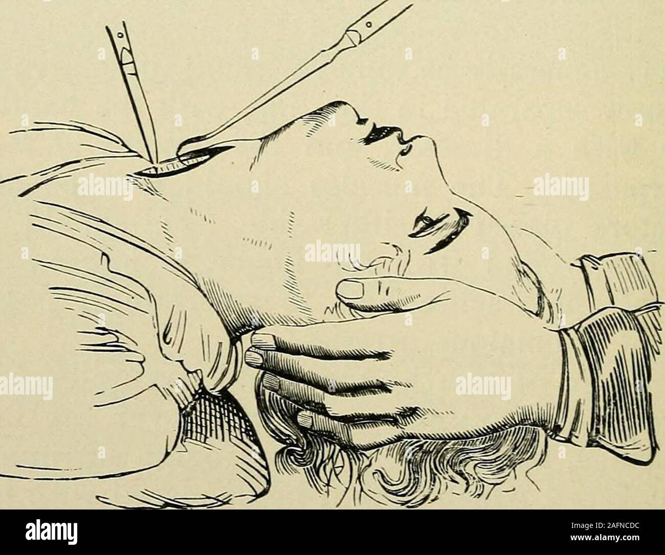 . Minor surgery and bandaging; including the treatment of fractures and ...