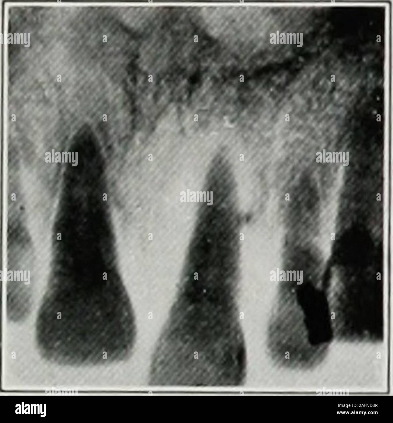 First radiograph hi-res stock photography and images - Alamy