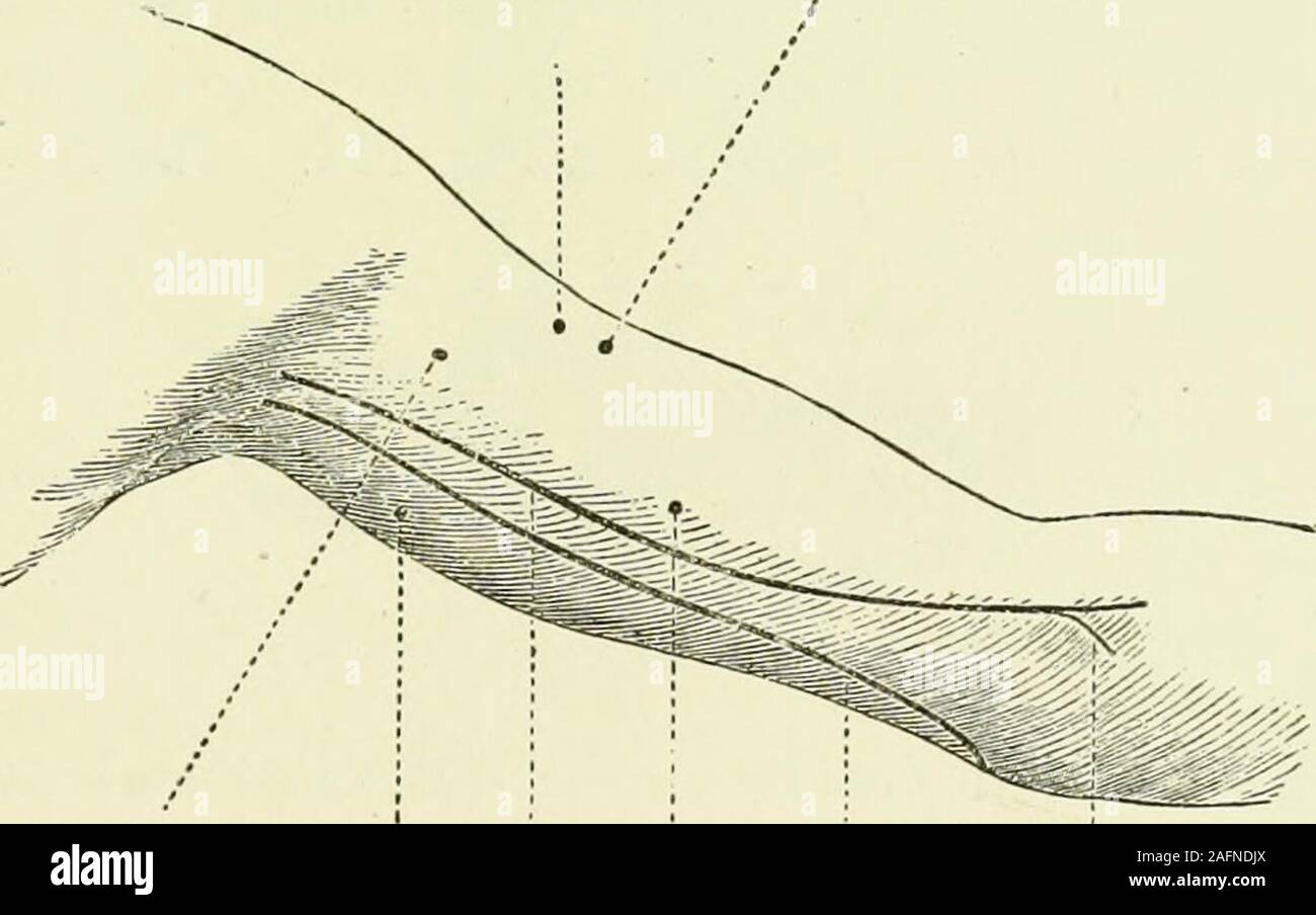 Supinator muscle hi-res stock photography and images - Alamy