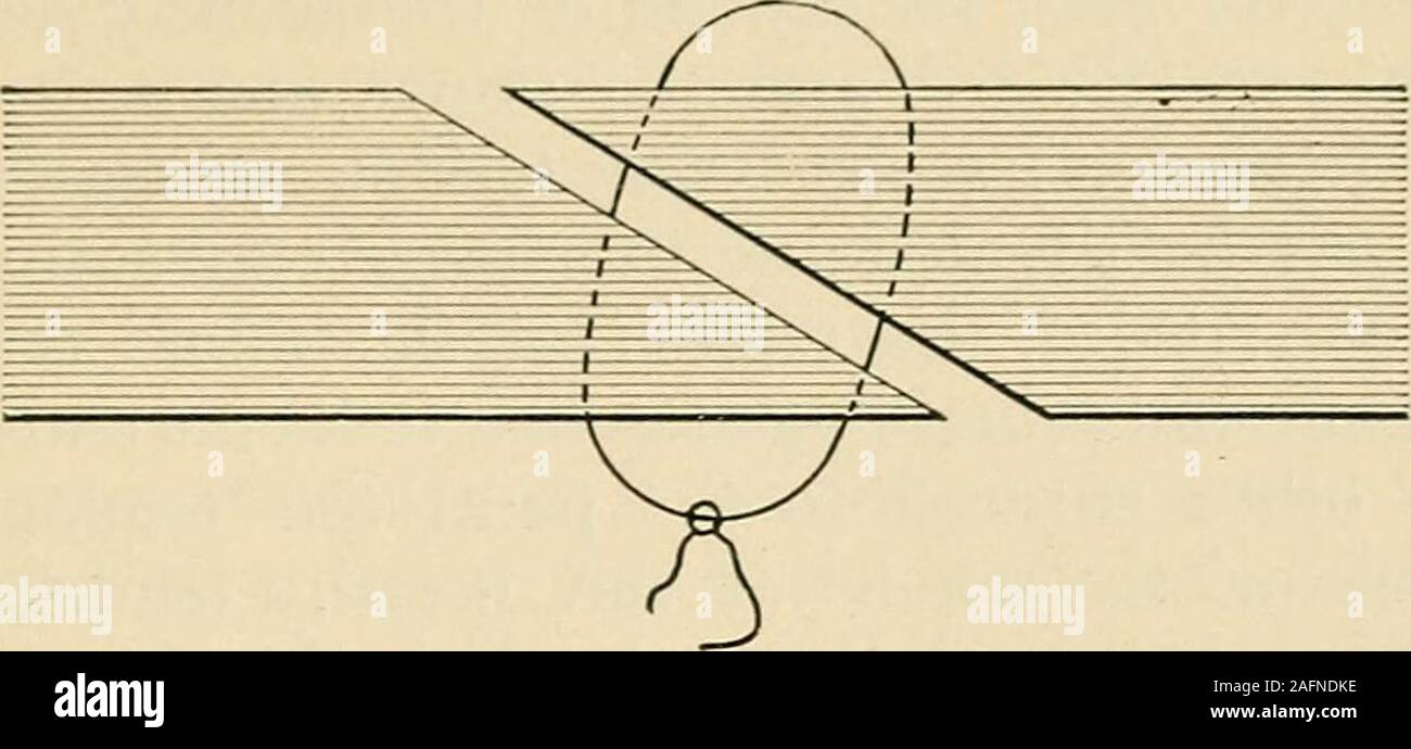 . Minor surgery and bandaging; including the treatment of fractures and ...