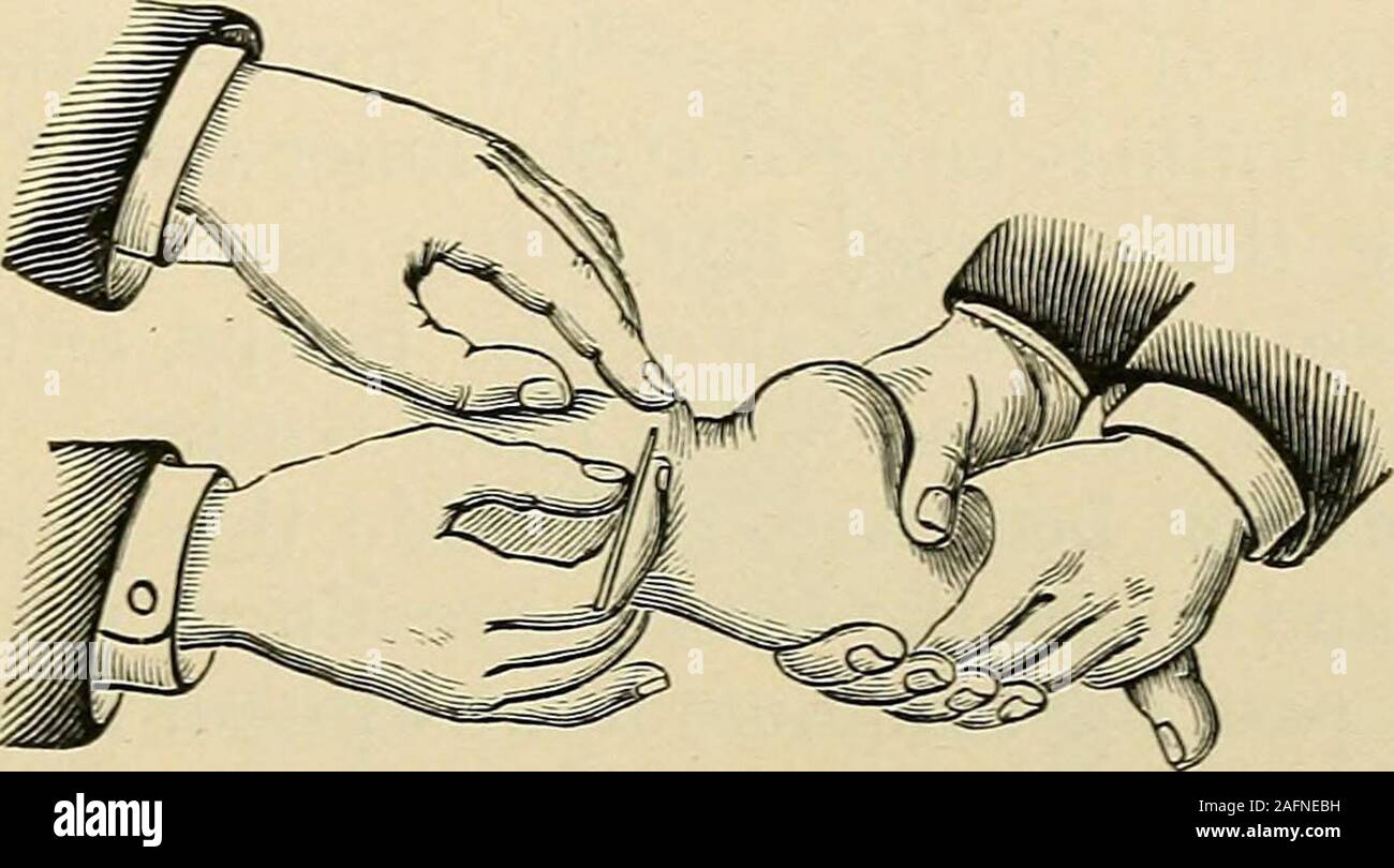 Tenotomy High Resolution Stock Photography and Images - Alamy