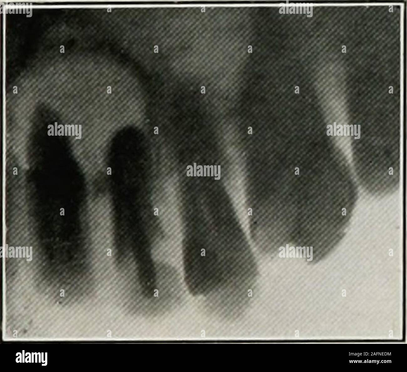 . Dental electro-therapeutics. Fig. 101.—Abscess involvingtwo roots of ...