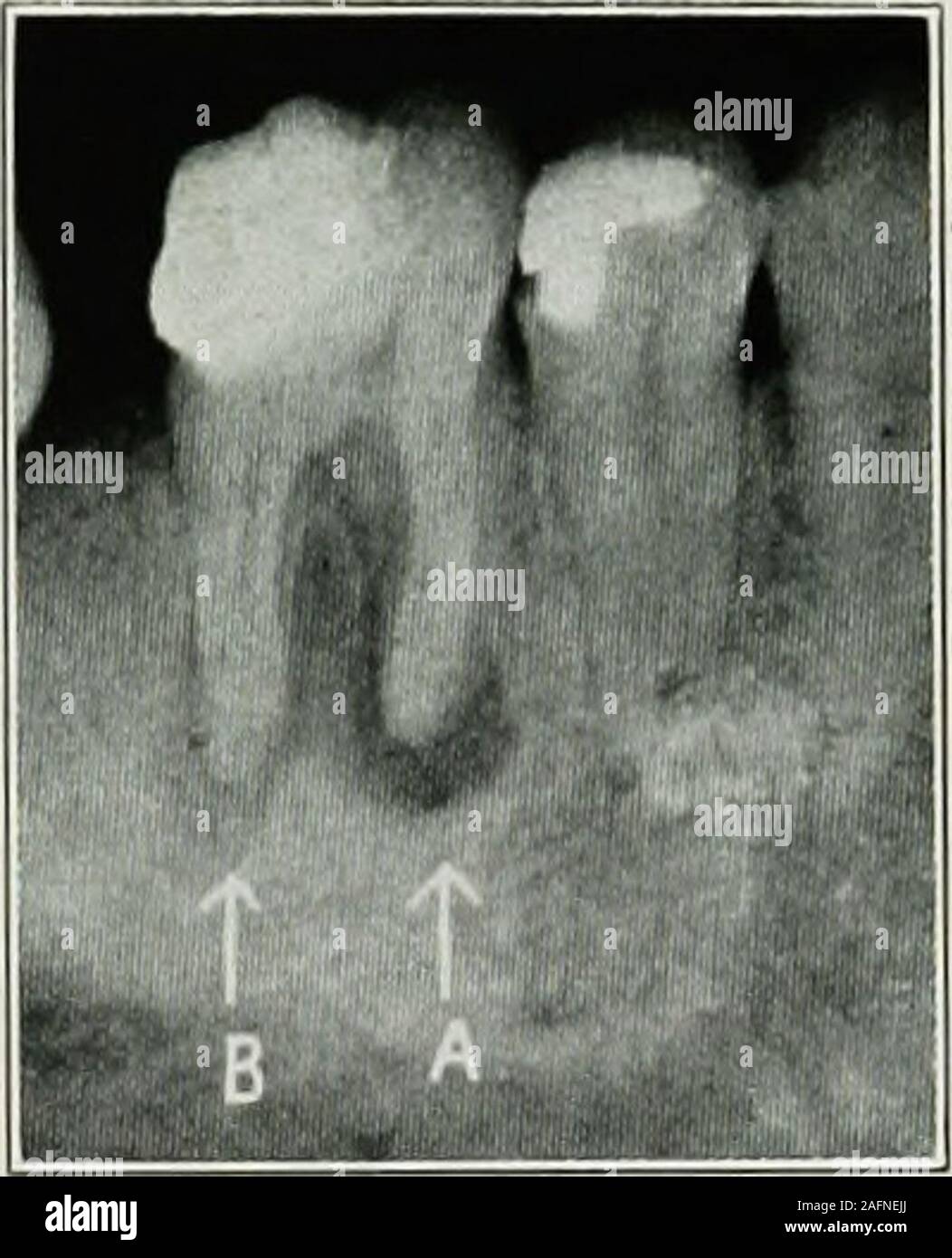 Electro dental hi-res stock photography and images - Alamy
