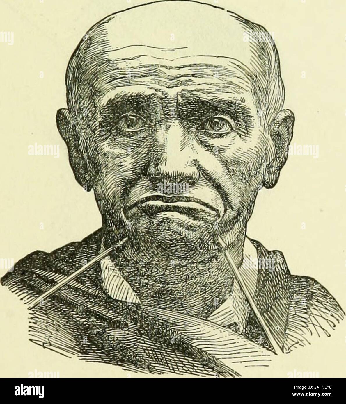 . Practical electricity in medicine and surgery. Fig. 146.—Contraction ...