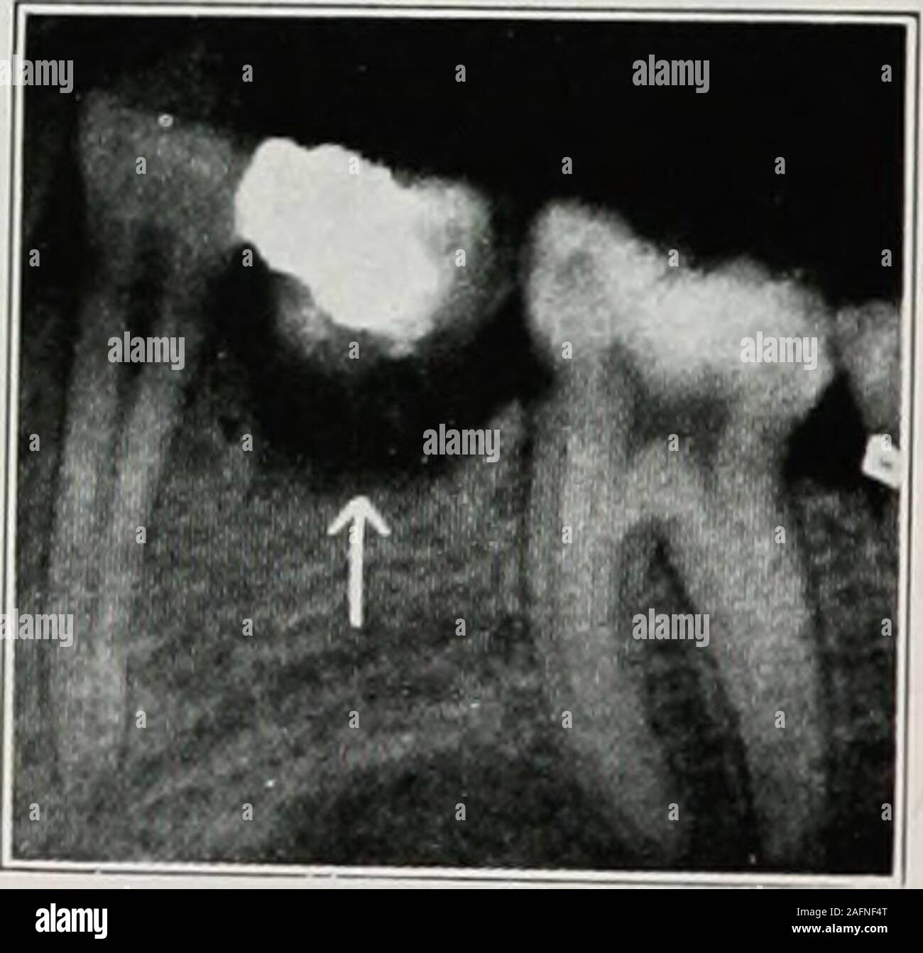 Negative Absorption High Resolution Stock Photography and Images - Alamy