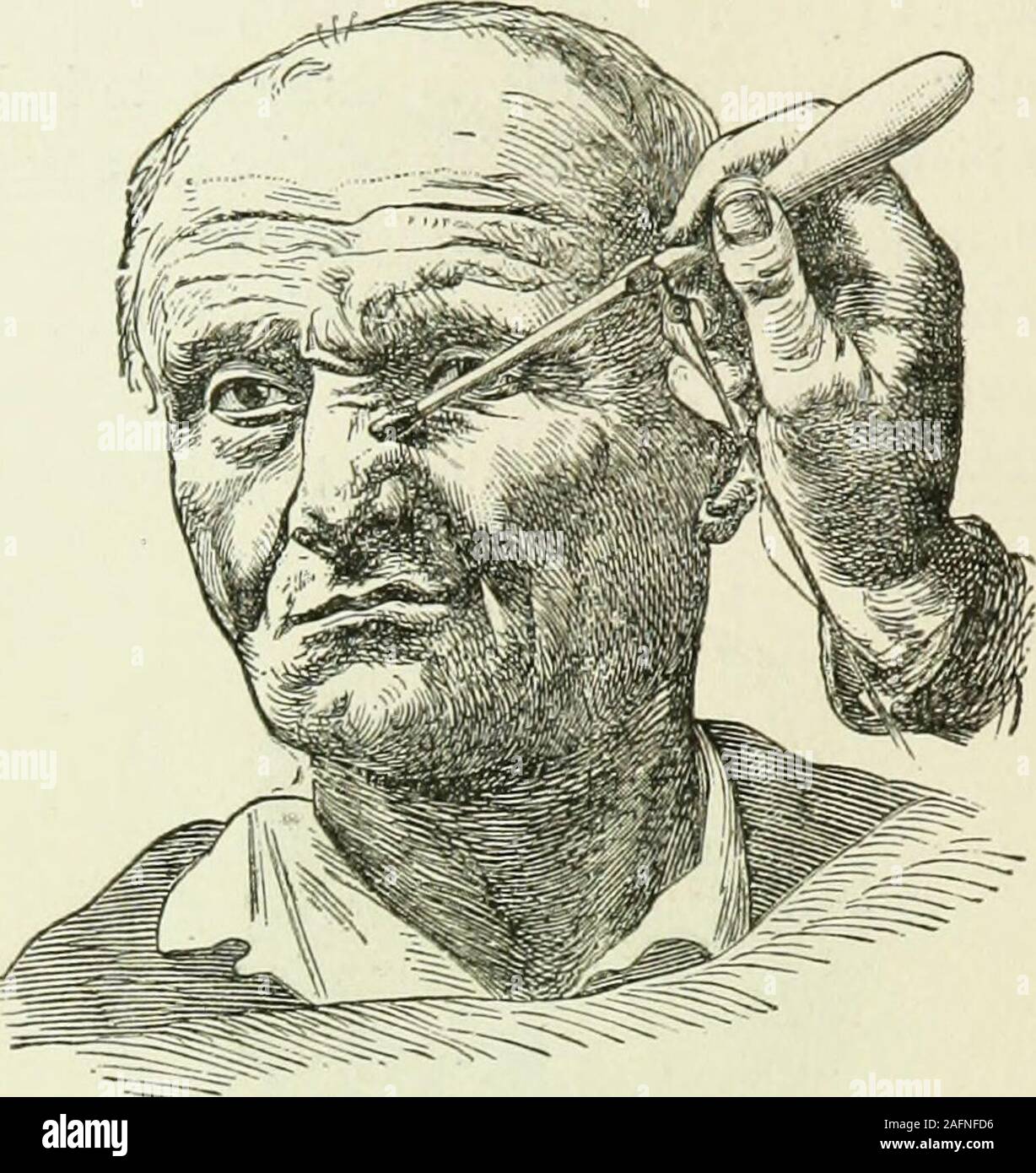 . Practical electricity in medicine and surgery. Fig. 144.—Contraction ...