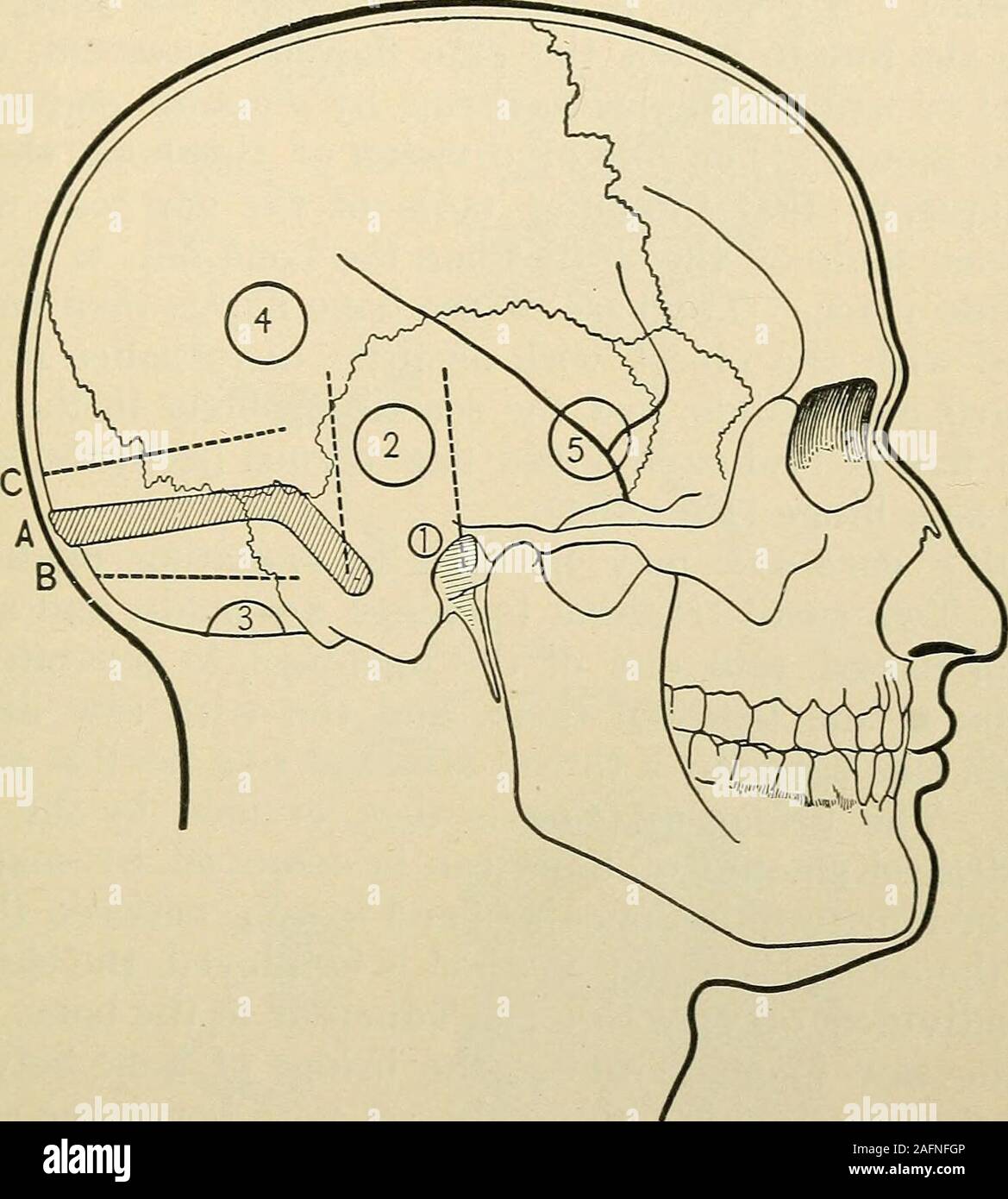. Minor surgery and bandaging; including the treatment of fractures and ...
