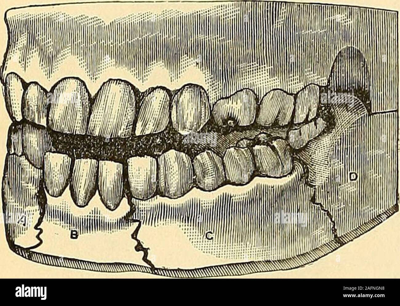 Lower jaw angles hi-res stock photography and images - Alamy