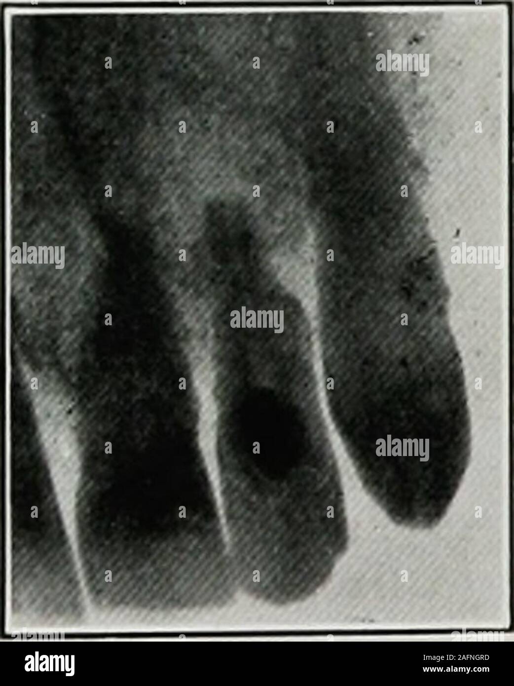 . Dental electro-therapeutics. Fig. 88 Fig. 89 Figs. 88 and 89. Cases ...