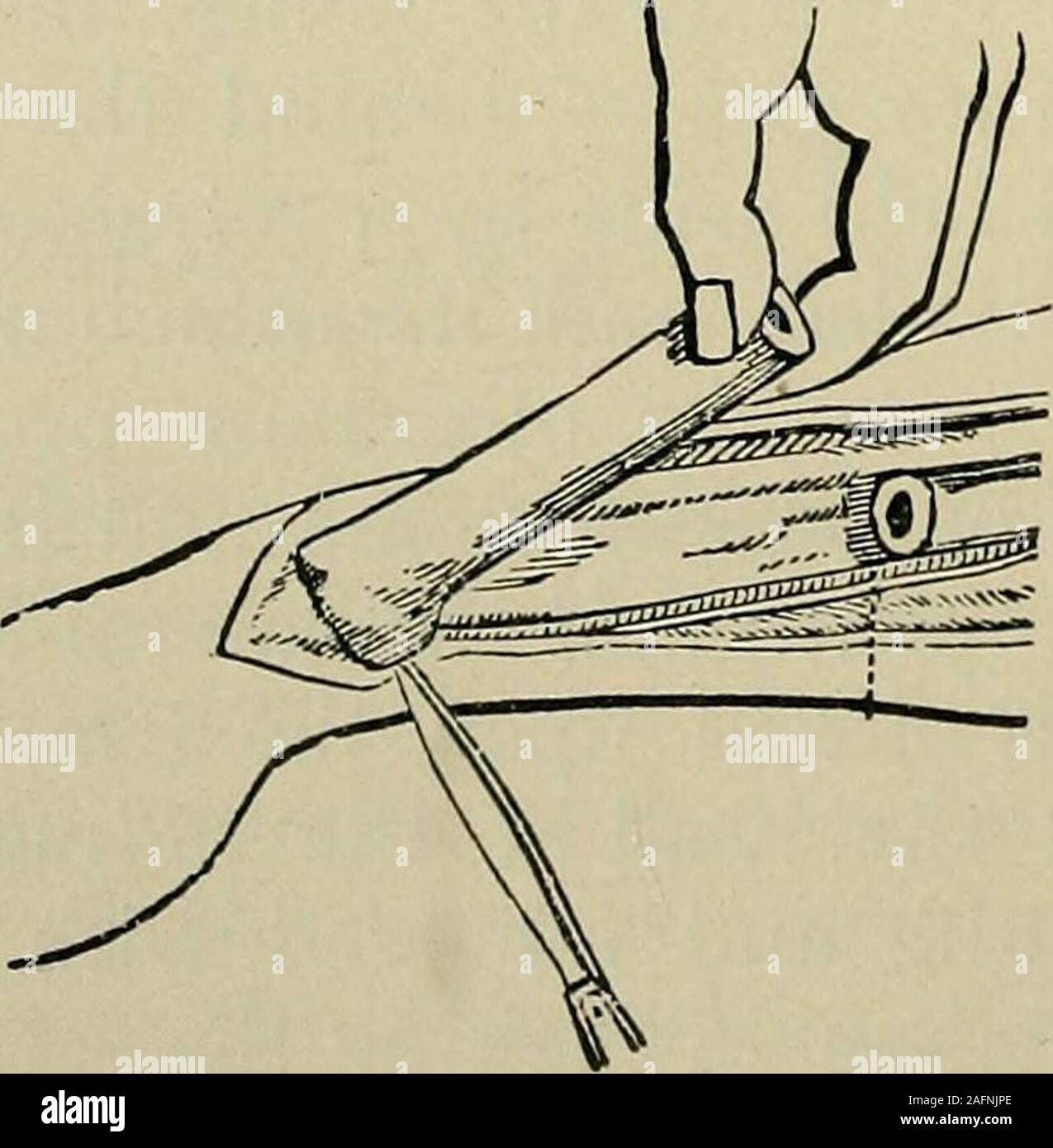 . Minor surgery and bandaging; including the treatment of fractures and ...