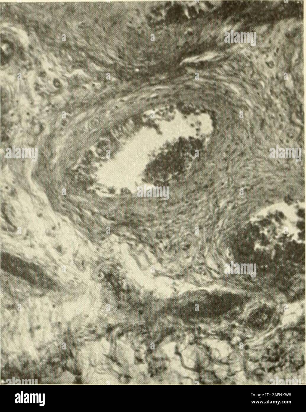 . A study of some factors influencing fertility and sterility in the ...