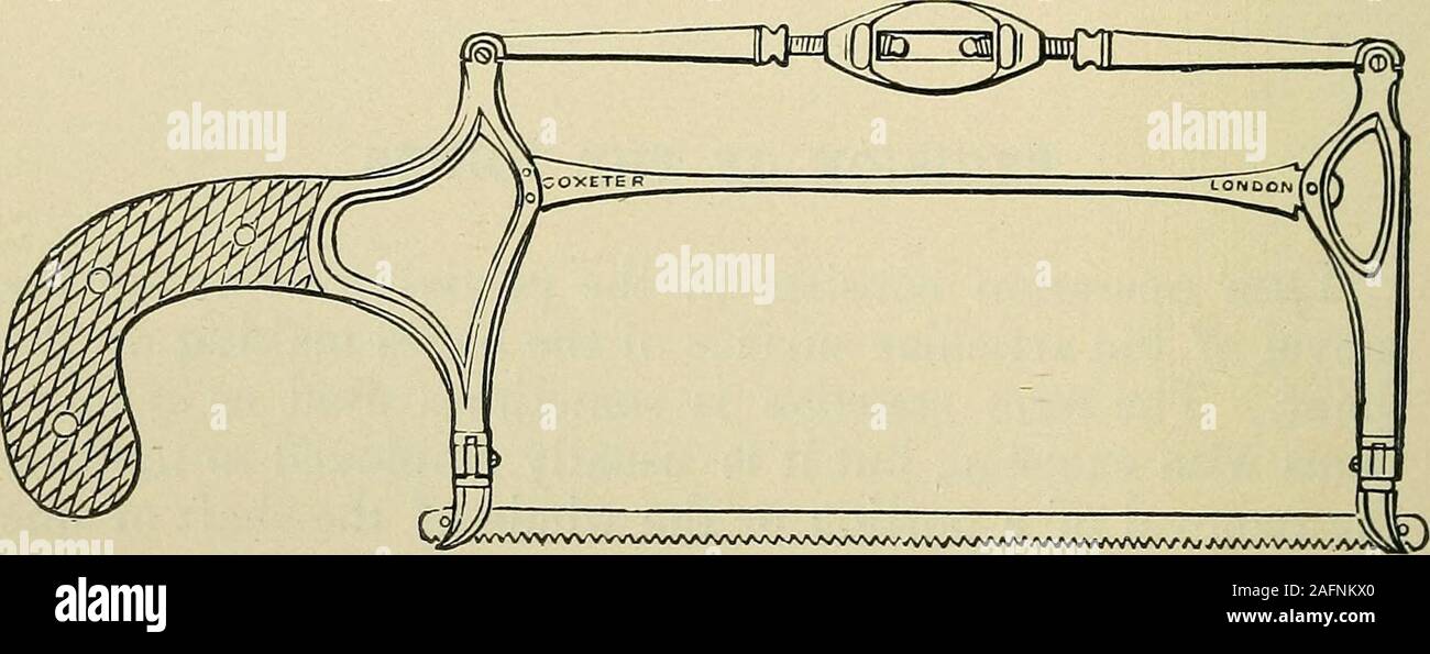 . Minor surgery and bandaging; including the treatment of fractures and ...