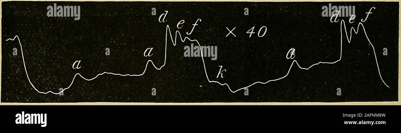 Appendix orifice hi-res stock photography and images - Alamy