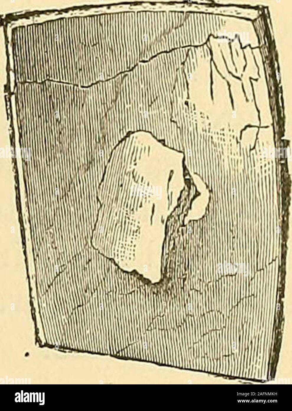 . The principles and practice of surgery. Outer plate. Inner plate ...