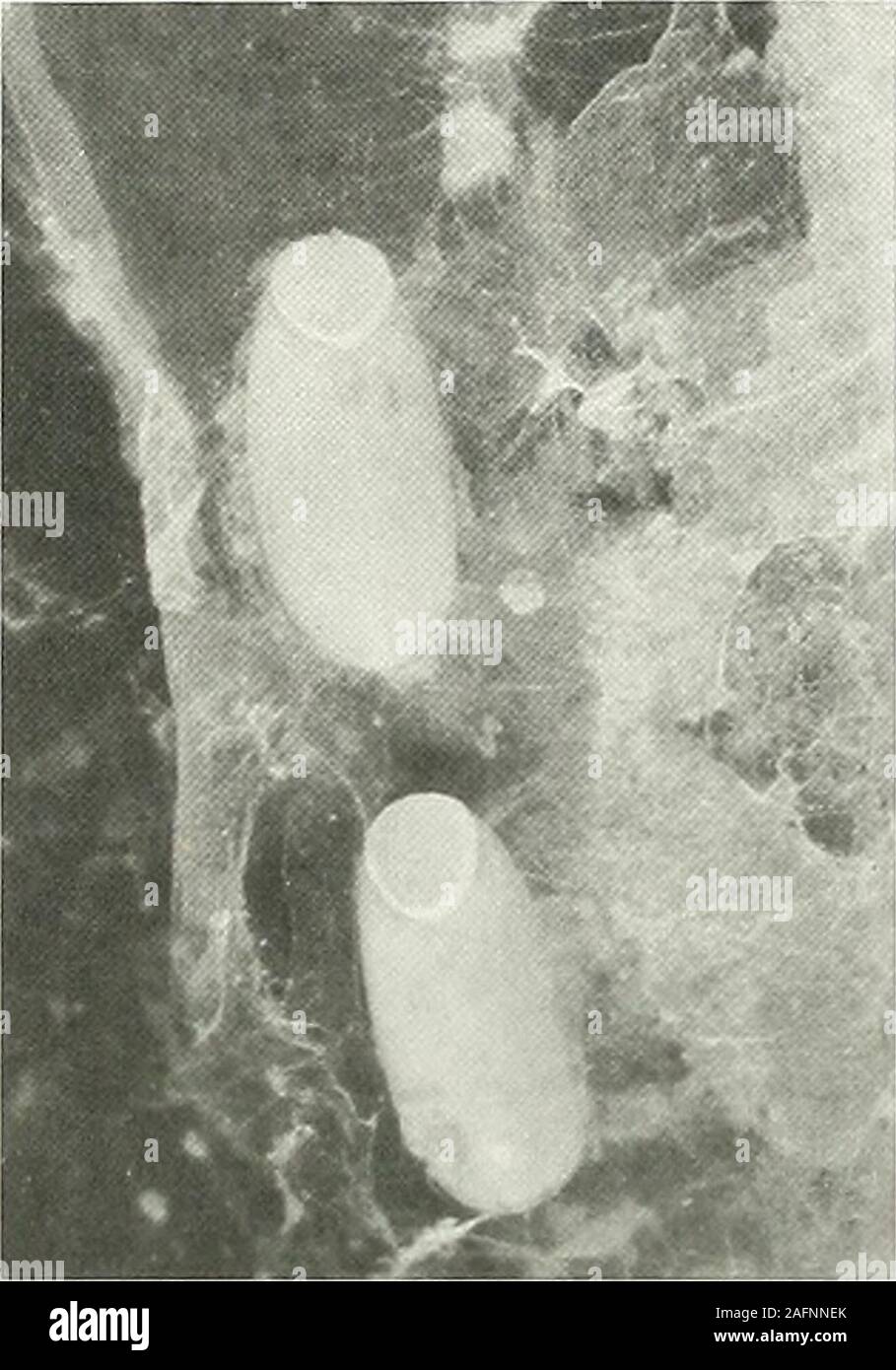 Ejaculatory duct hi-res stock photography and images - Alamy