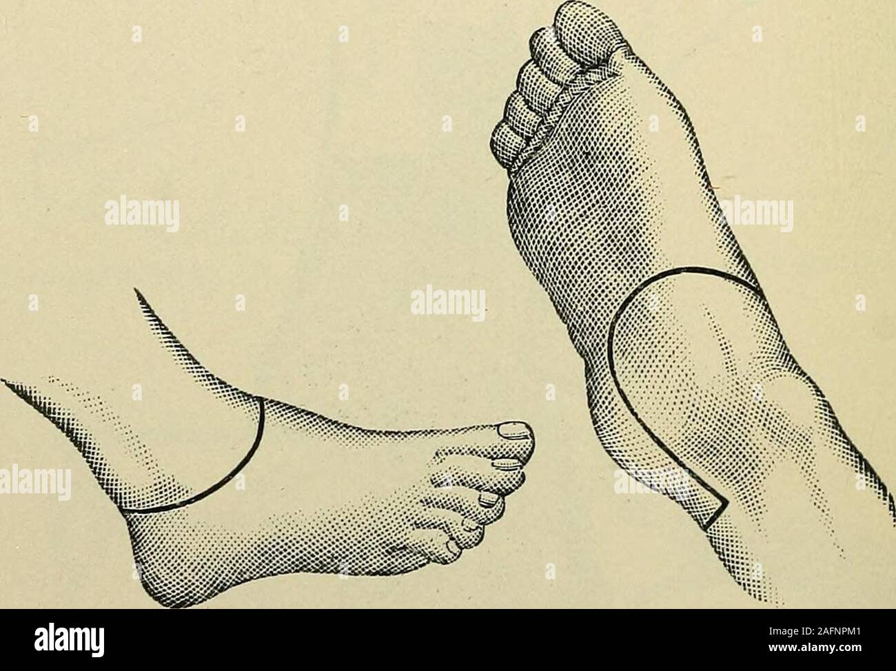 . Minor surgery and bandaging; including the treatment of fractures and ...