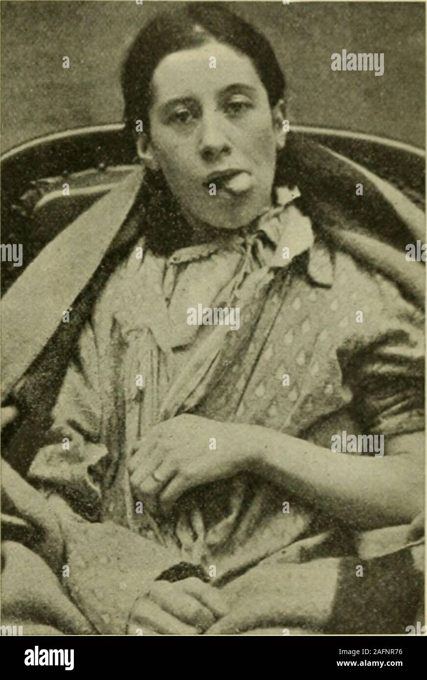 Hysterical paralysis hi-res stock photography and images - Alamy