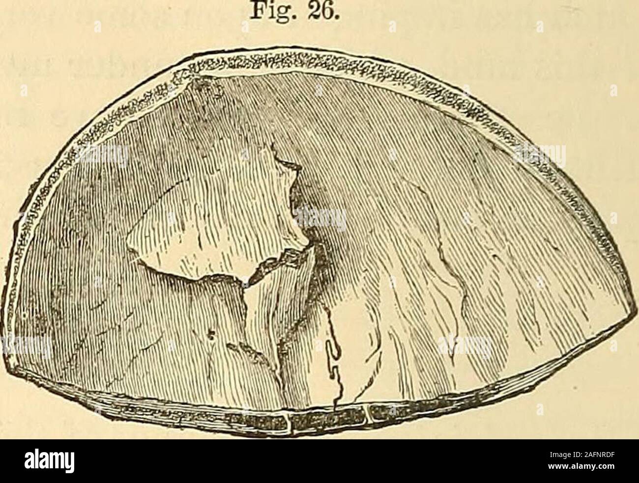. The principles and practice of surgery. Outer Table. Fissure of the ...