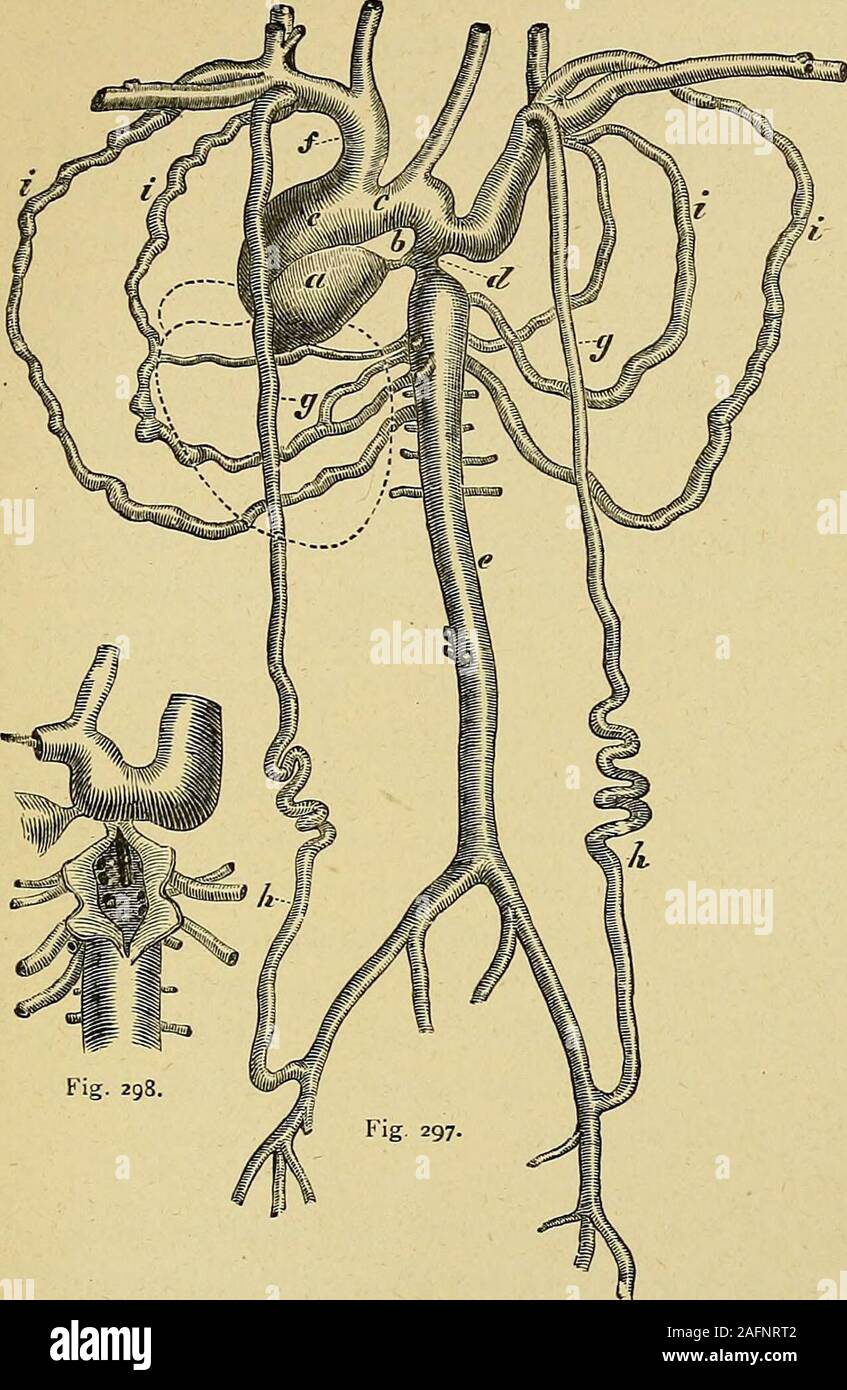 Ductus arteriosus hi-res stock photography and images - Alamy