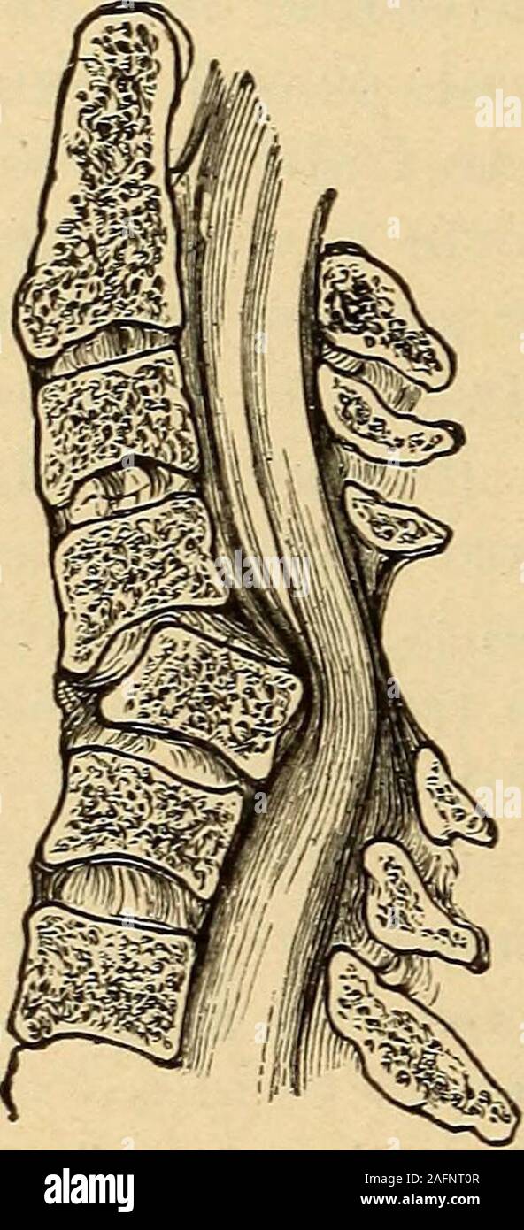 Ligamenta flava hi-res stock photography and images - Alamy