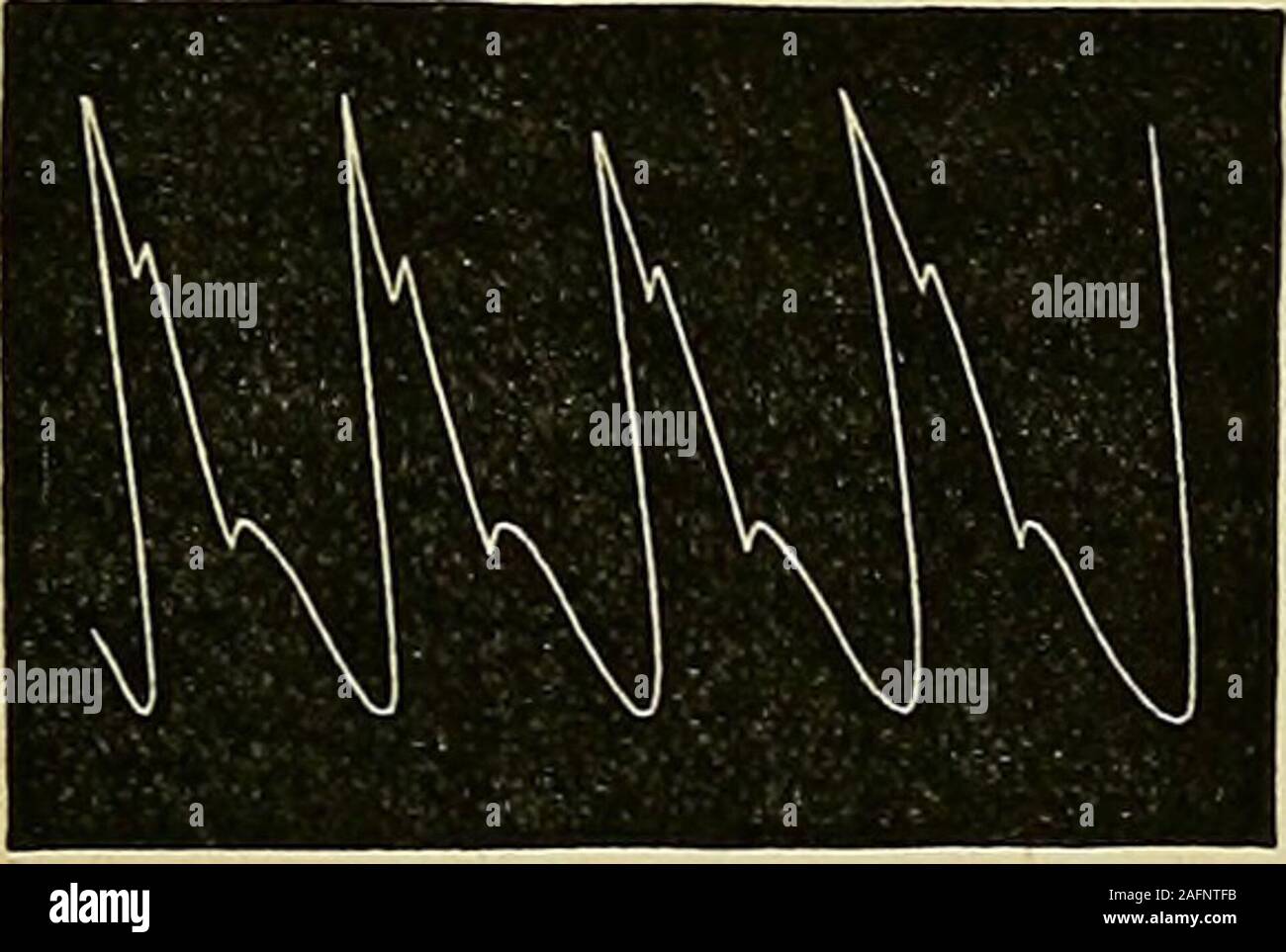 Characteristic notch hi-res stock photography and images - Alamy
