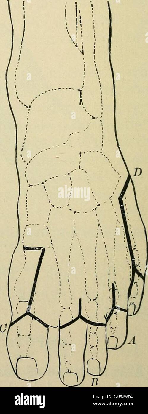 . Minor surgery and bandaging; including the treatment of fractures and ...