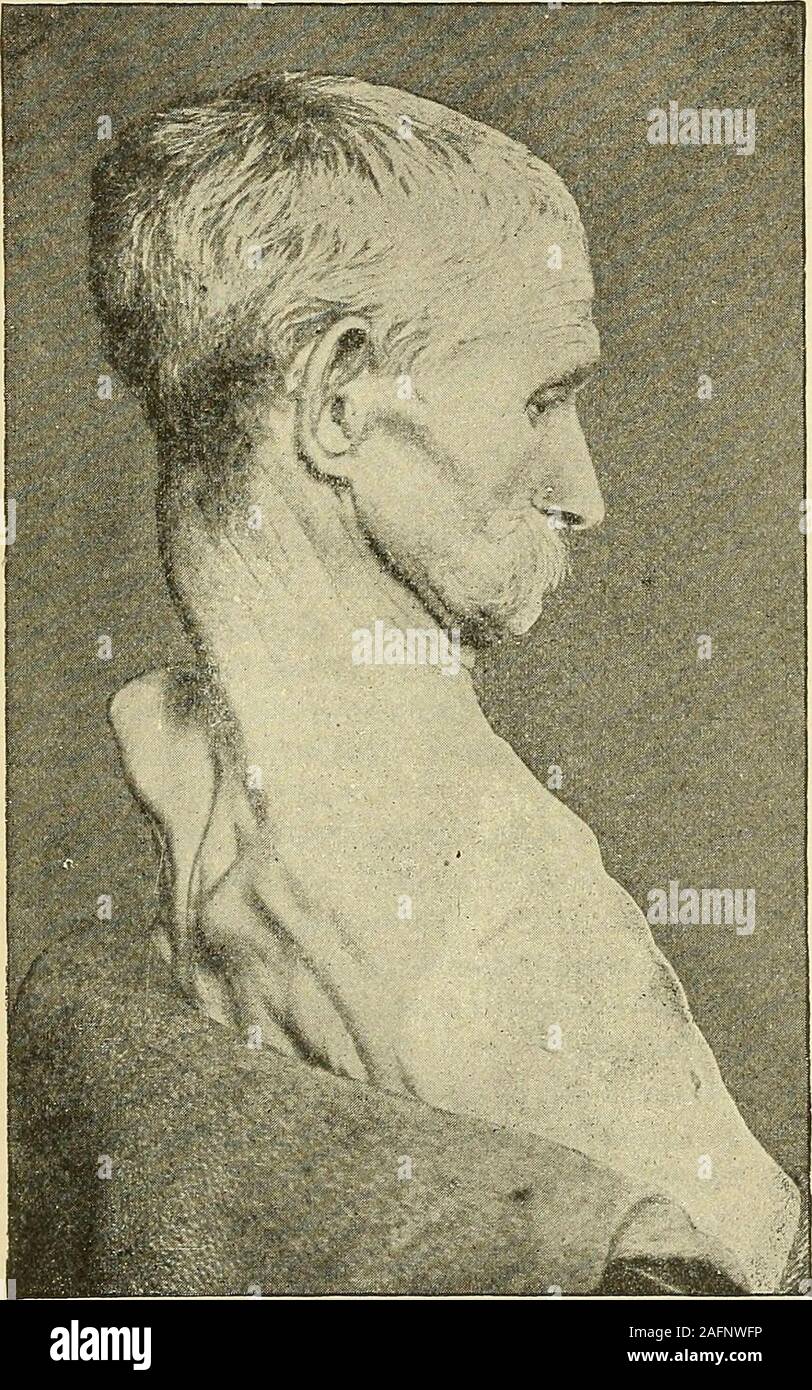 Plegia High Resolution Stock Photography and Images - Alamy