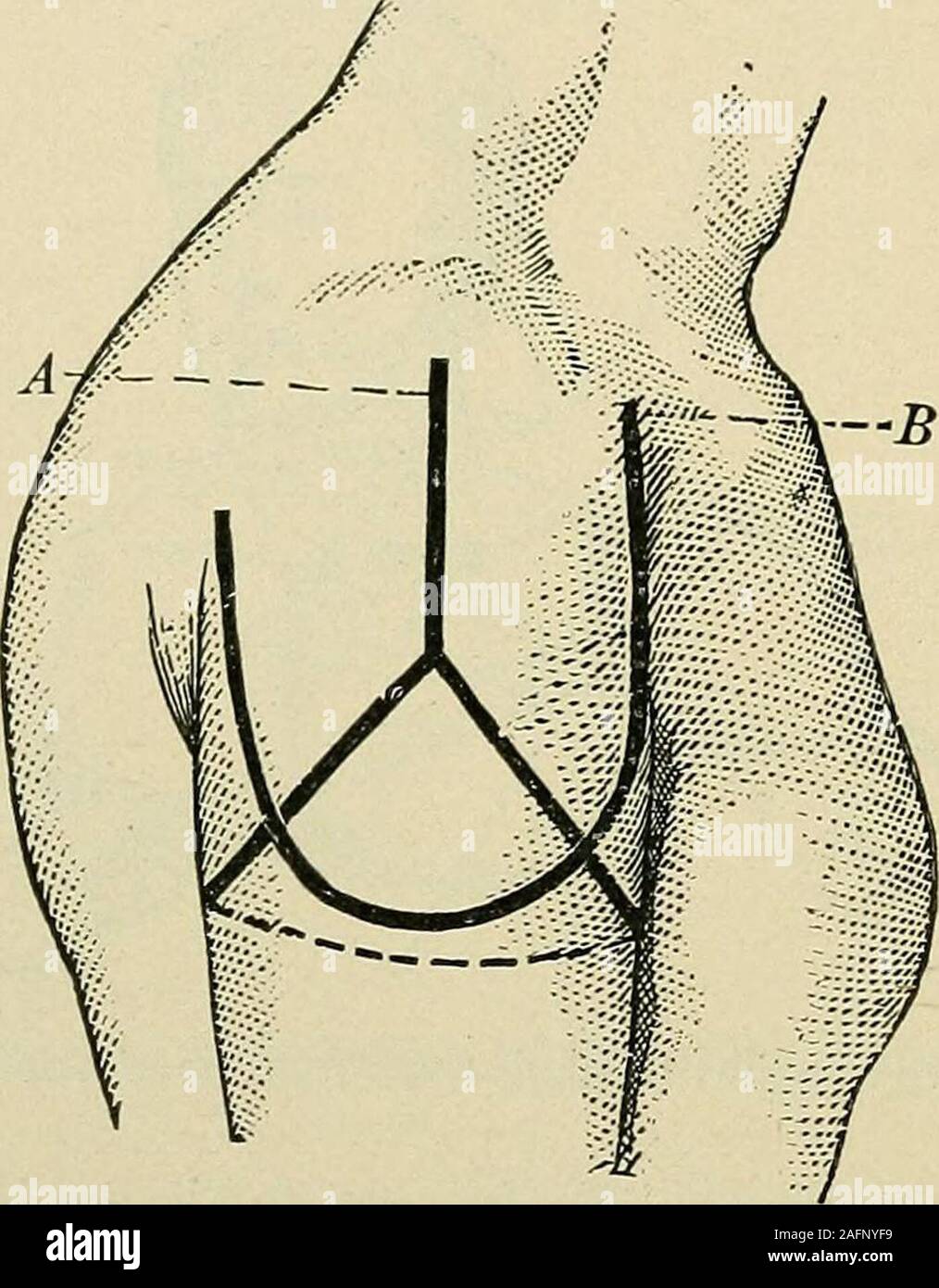 . Minor surgery and bandaging; including the treatment of fractures and ...