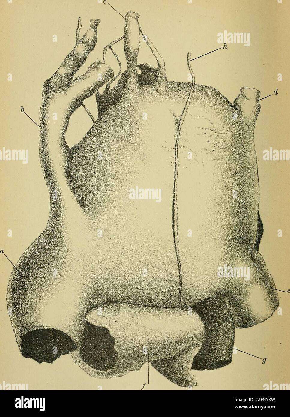 . Diseases of the heart and thoracic aorta. Fig. 286. Aneurism ...