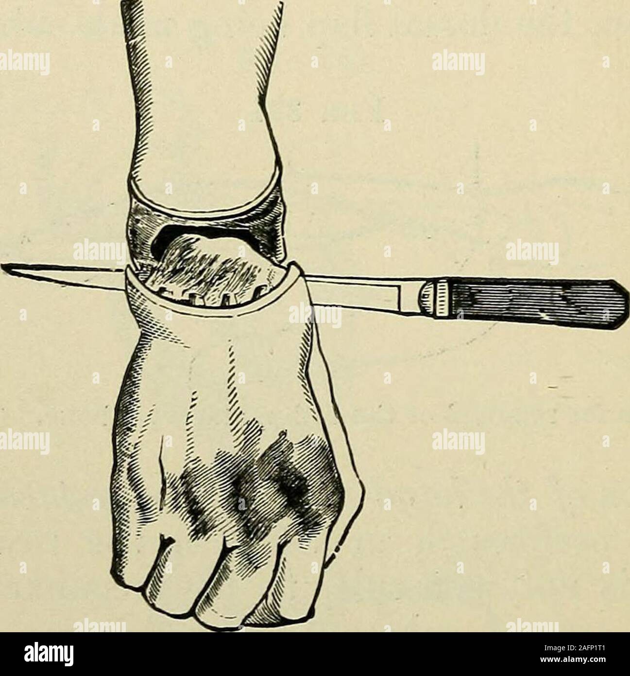 . Minor surgery and bandaging; including the treatment of fractures and ...