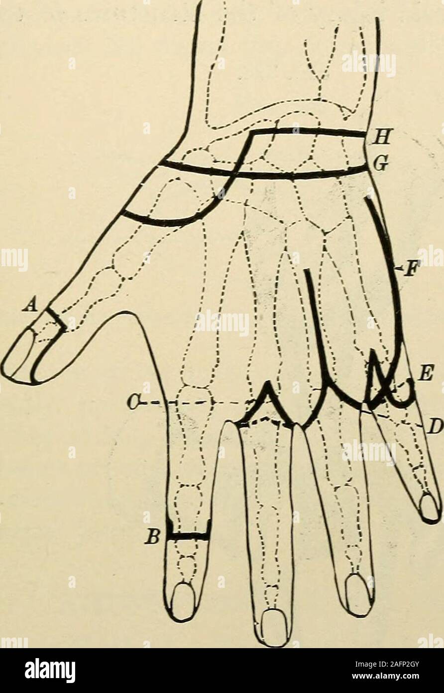 . Minor surgery and bandaging; including the treatment of fractures and ...