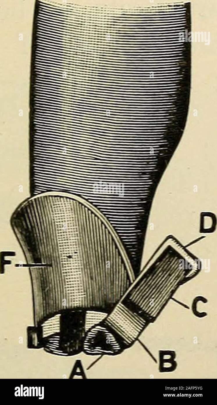 . Minor surgery and bandaging; including the treatment of fractures and ...