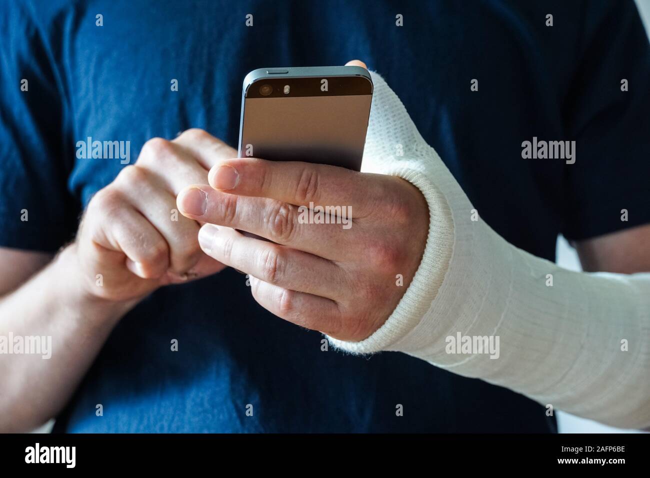 Thumb spica cast hi-res stock photography and images - Alamy