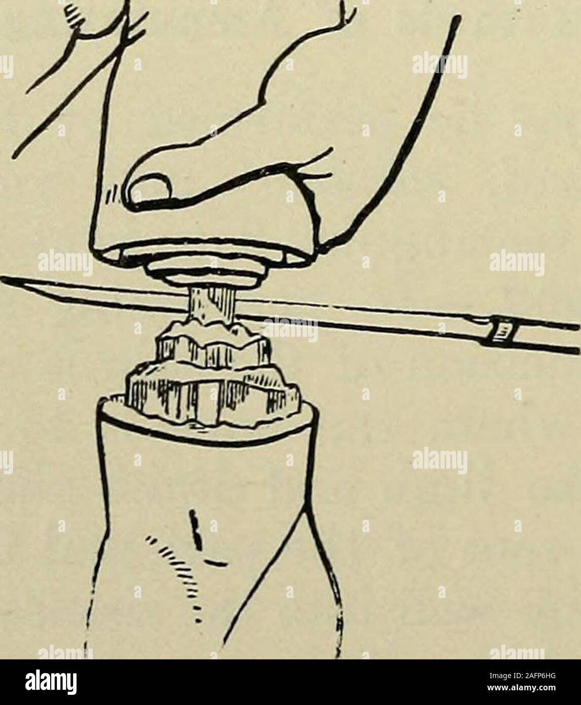. Minor surgery and bandaging; including the treatment of fractures and ...