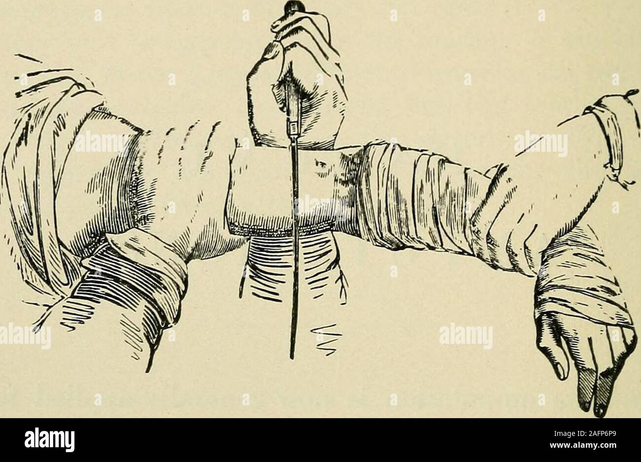 . Minor surgery and bandaging; including the treatment of fractures and ...