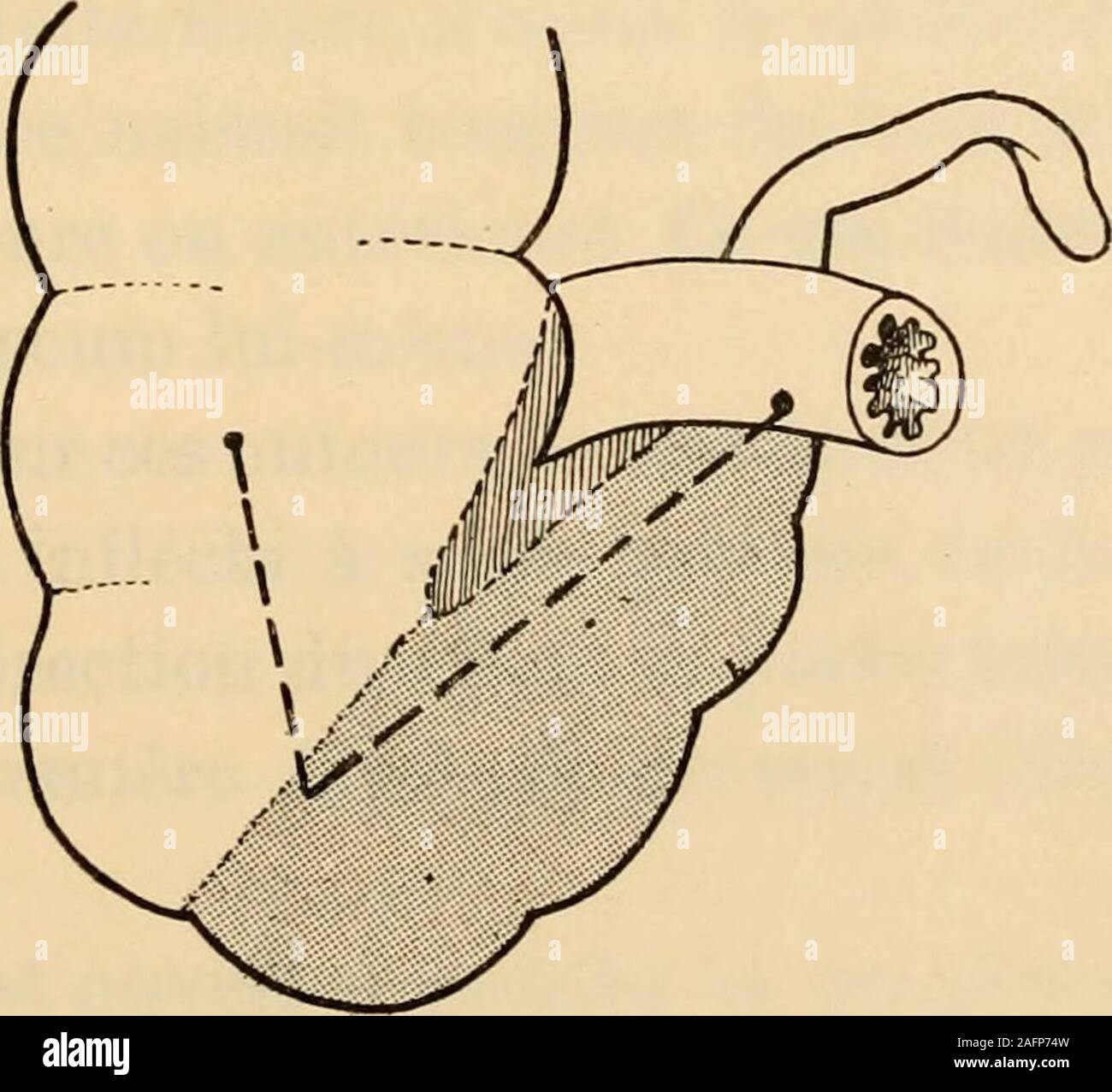 Anatomie du caecum hi-res stock photography and images - Alamy