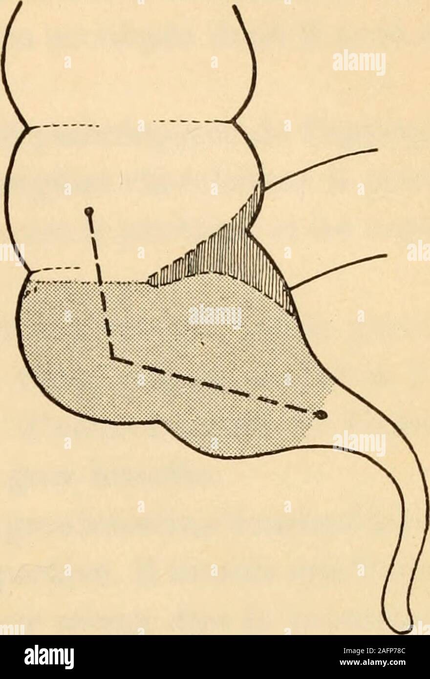 Anatomie du caecum hi-res stock photography and images - Alamy