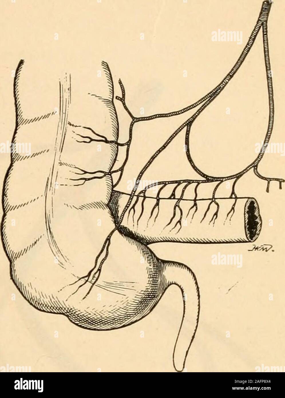 . Anatomie médico-chirurgicale de l'abdomen. Fig. 43. ?— La dernière ...