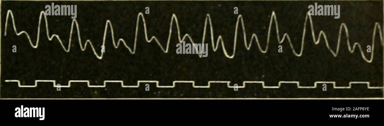 . Internal medicine; a work for the practicing physician on diagnosis ...