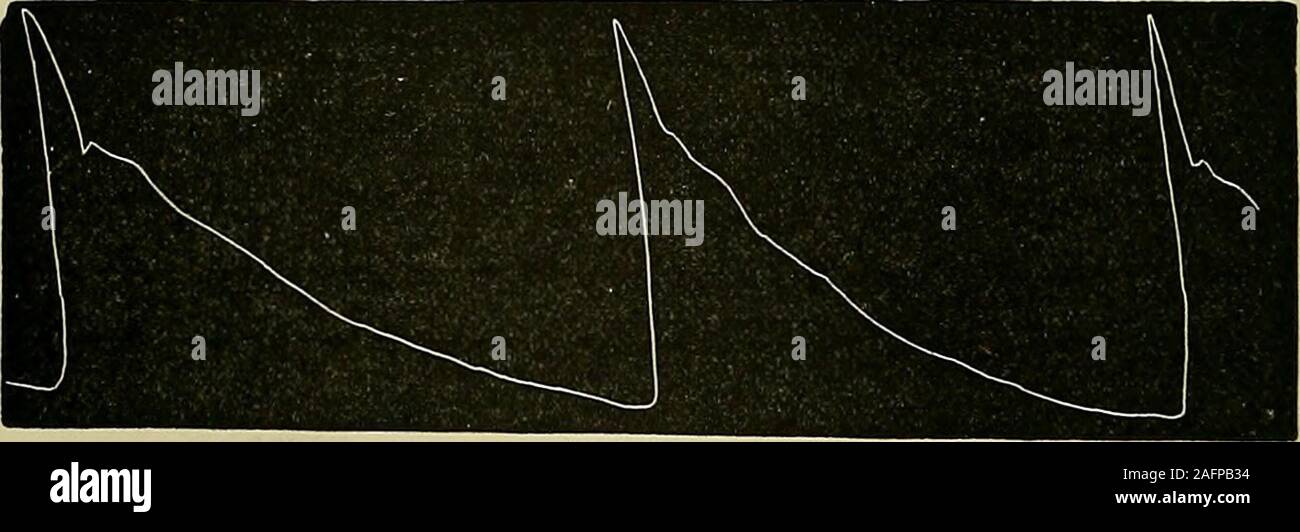 . Diseases of the heart and thoracic aorta. Piessure 5 ozs. Fig. 249 ...