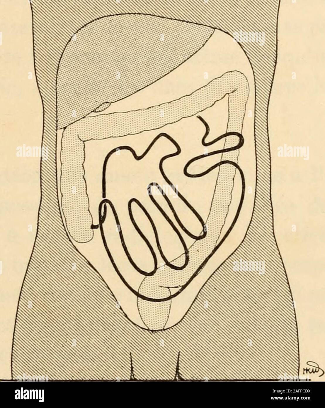 . Anatomie médico-chirurgicale de l'abdomen. Fig. 34. — Disposition et ...
