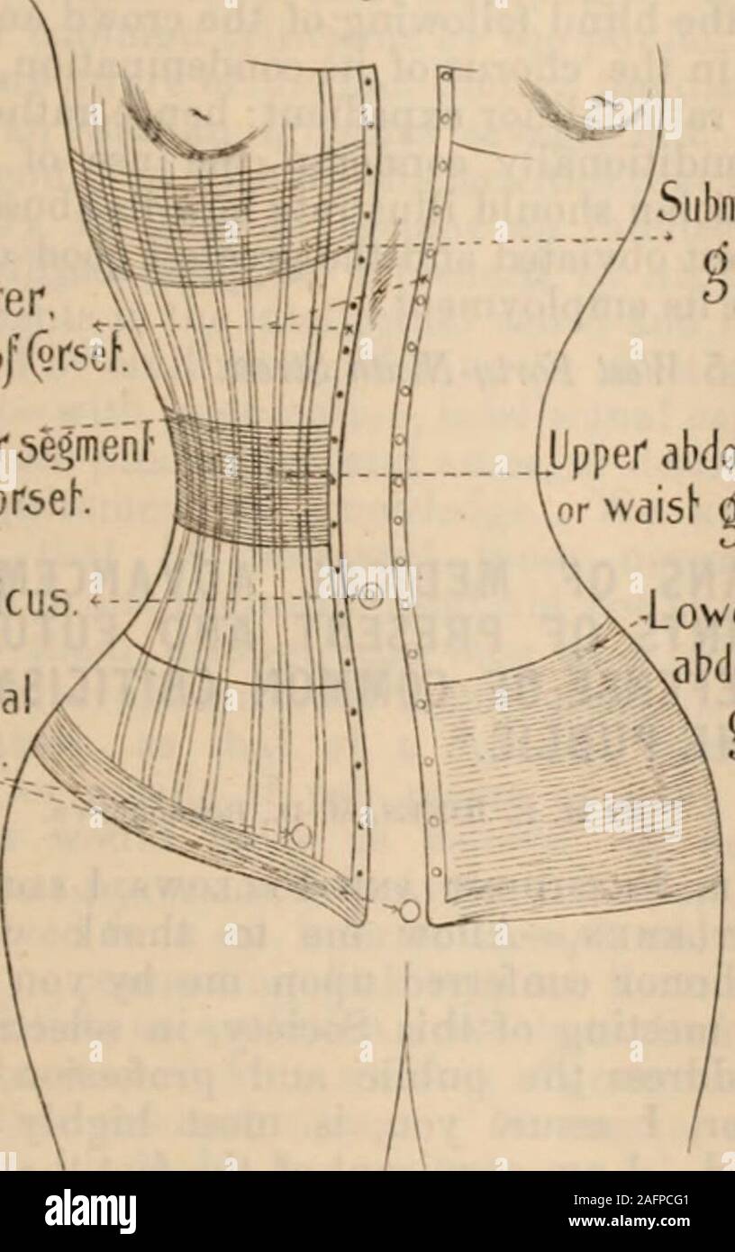 . Virginia medical semi-monthly. nt prolapse and atrophy of the abdom ...