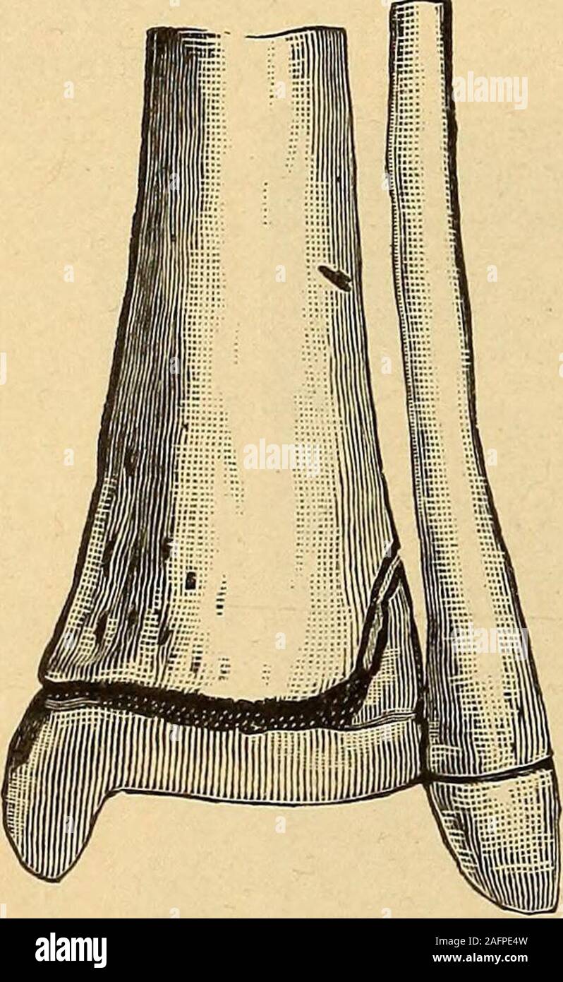 100 foot fall hi-res stock photography and images - Alamy