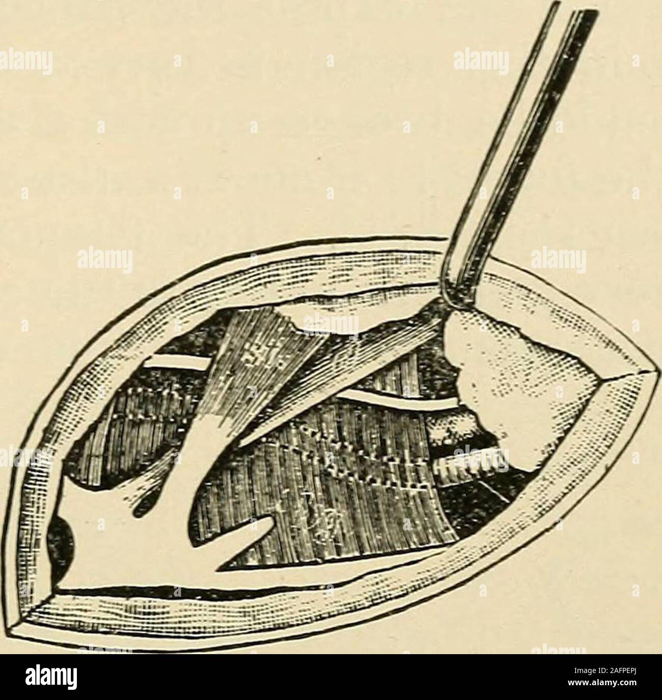 . Minor surgery and bandaging; including the treatment of fractures and ...