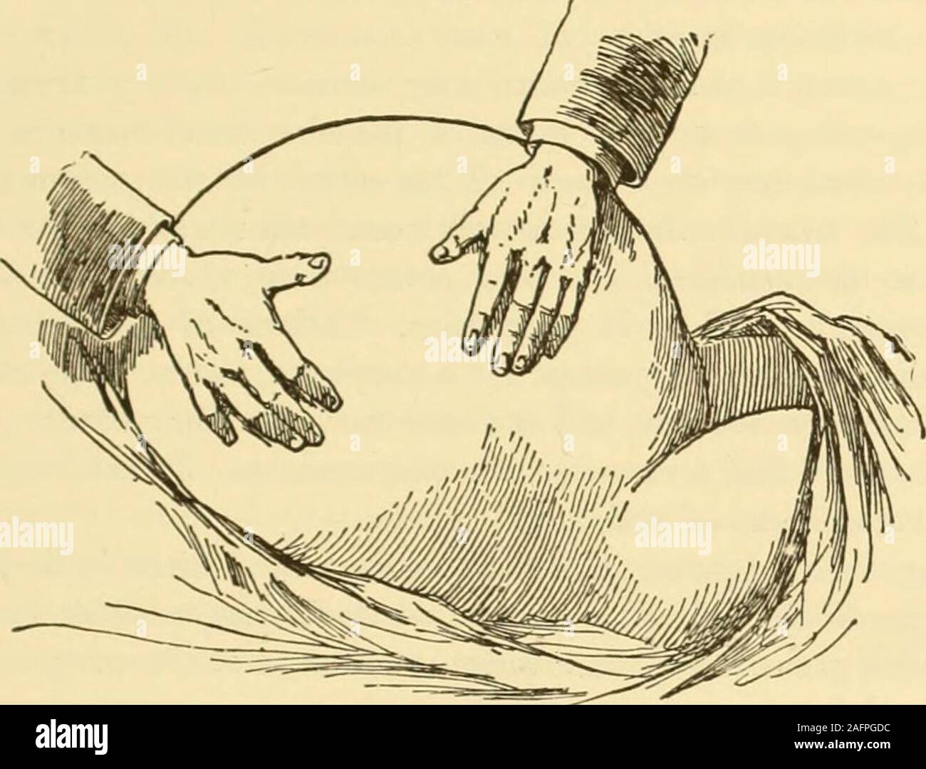 . Clinical gyncology, medical and surgical. he entire abdomen with one ...