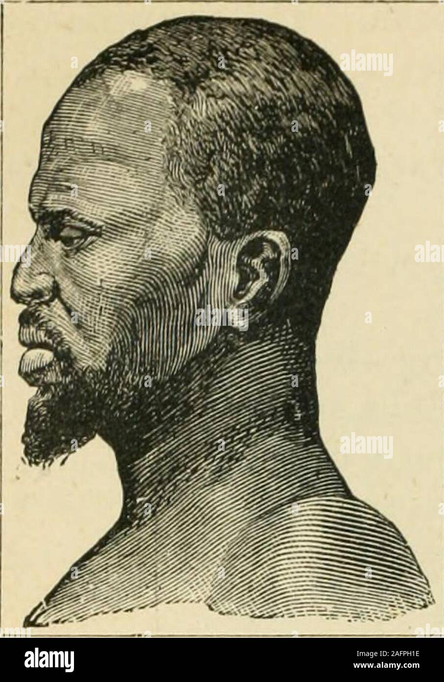 Ruddy complexion hi-res stock photography and images - Alamy