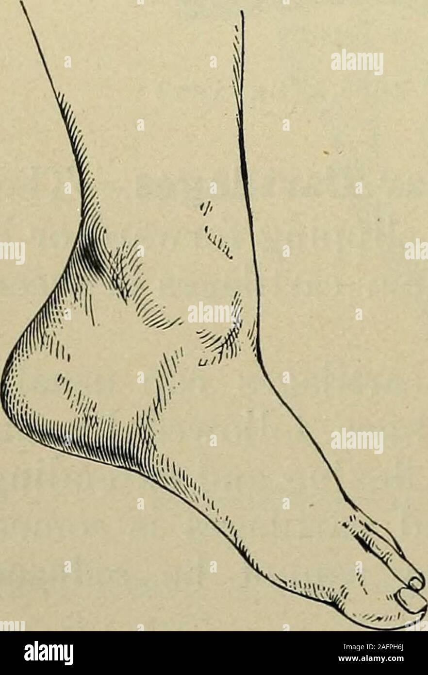 . Minor surgery and bandaging; including the treatment of fractures and ...