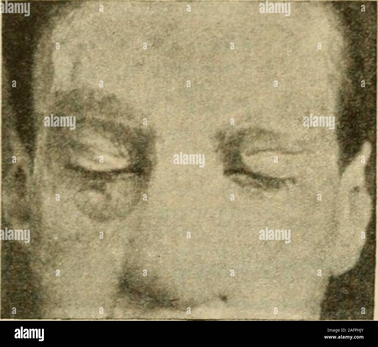 Horse hair trim hi-res stock photography and images - Alamy