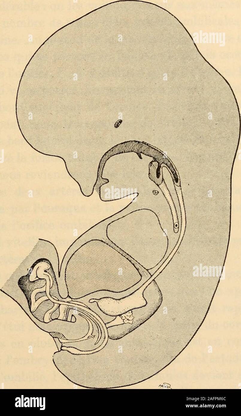 C fistule hi-res stock photography and images - Alamy