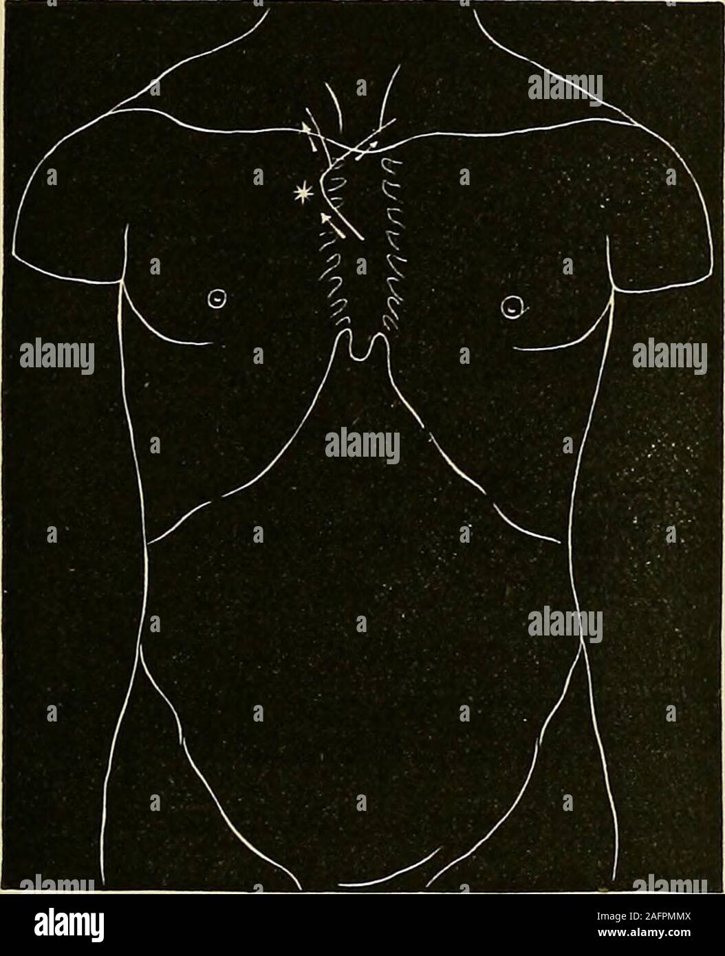 . Diseases of the heart and thoracic aorta. n addition to the systolic ...